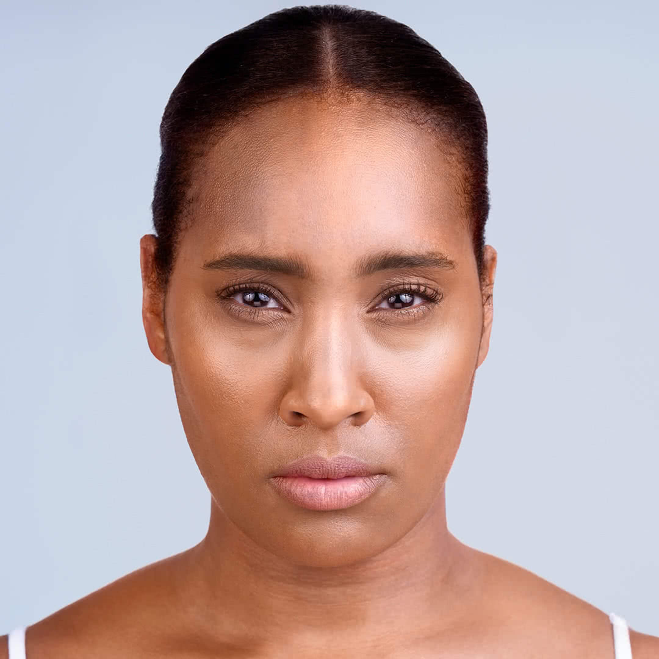 Frown Lines Before and After - Xeomin Aesthetic