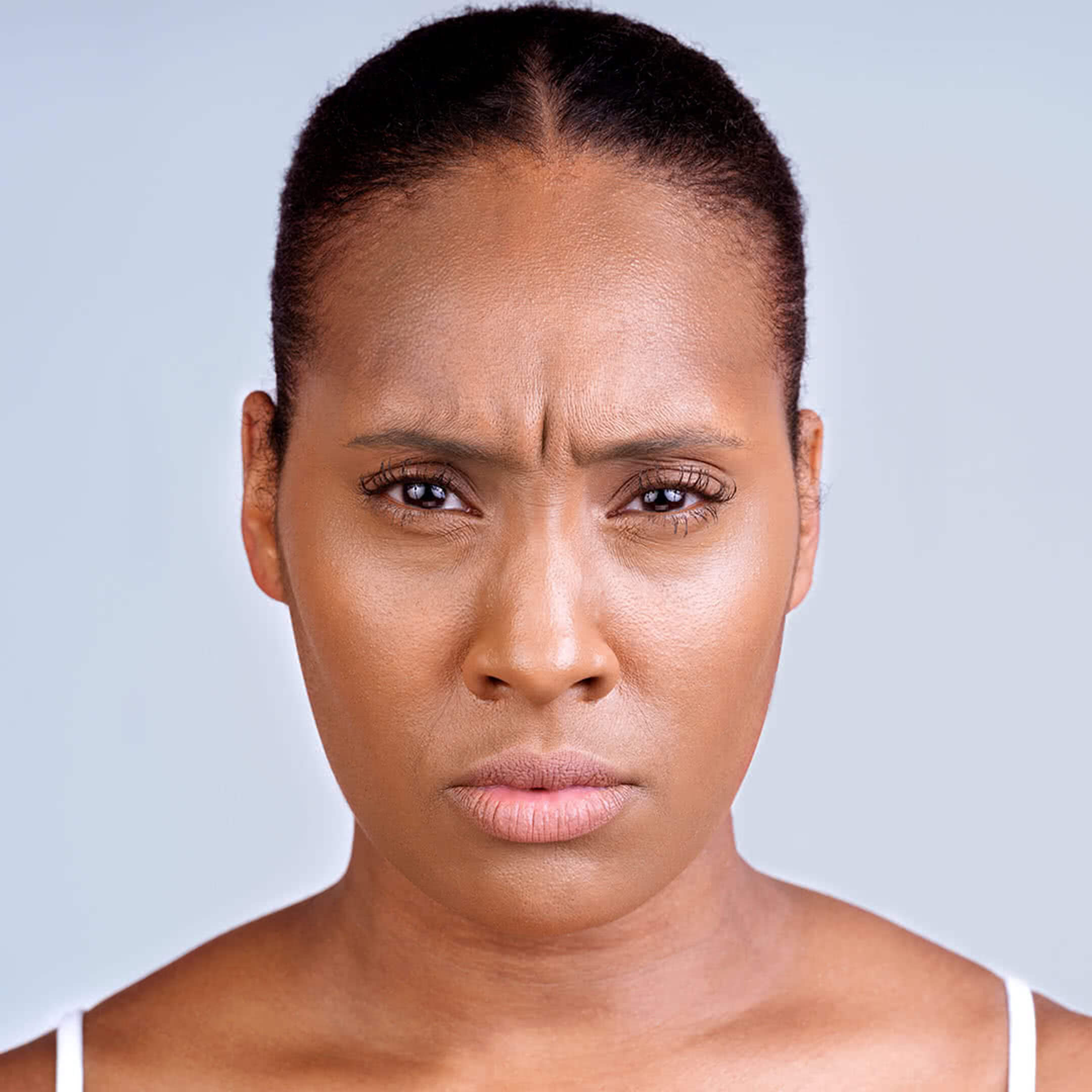 Frown Lines Before and After - Xeomin Aesthetic